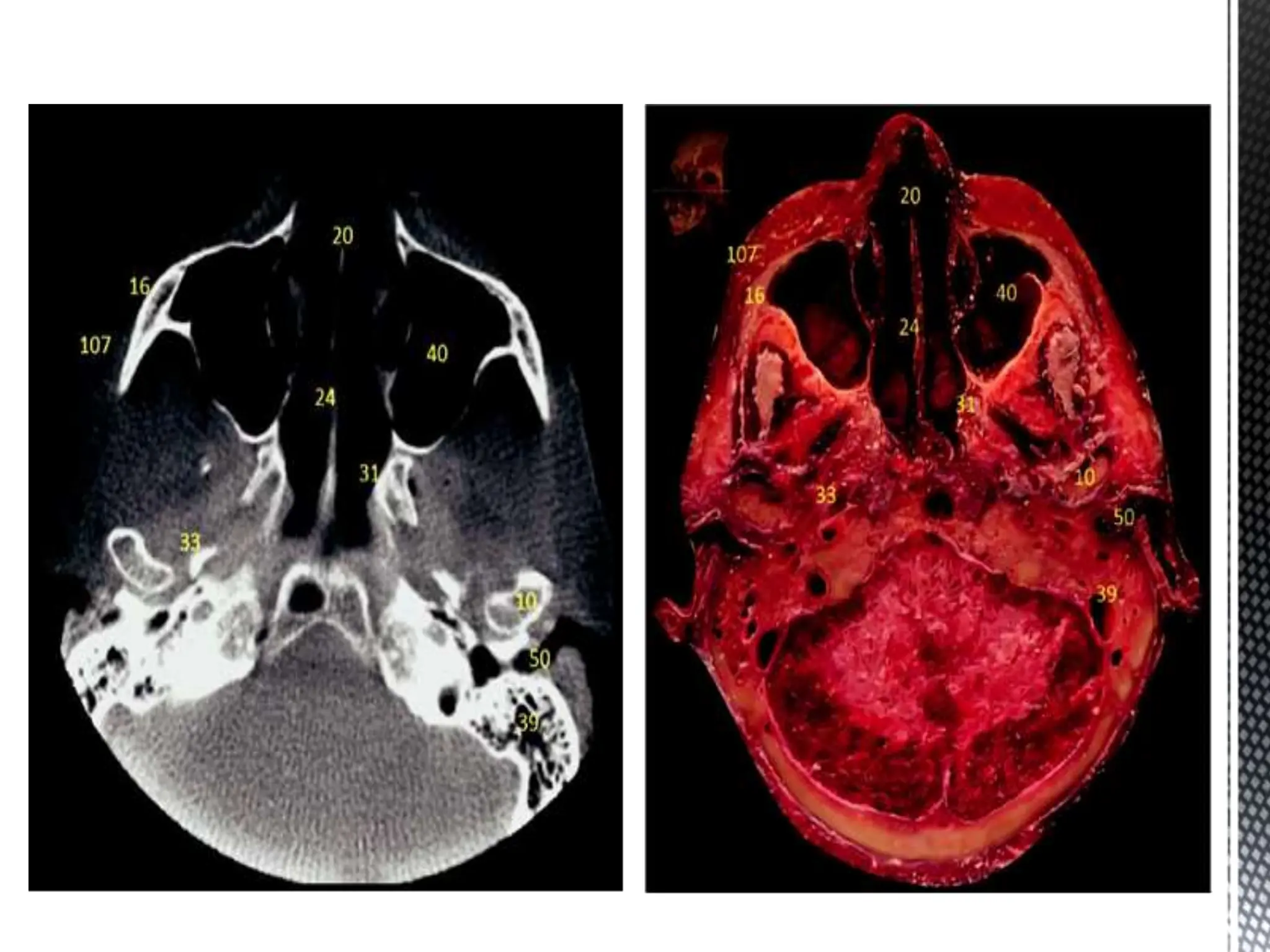 CBCT_INTERPRETATION CBCT APPLICATIONS & READING.pptx