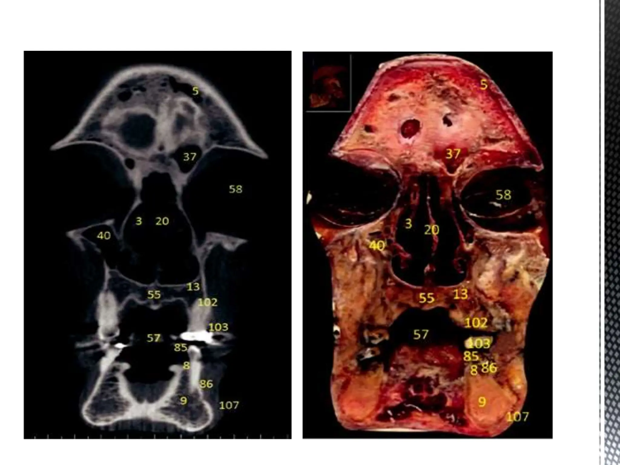 CBCT_INTERPRETATION CBCT APPLICATIONS & READING.pptx