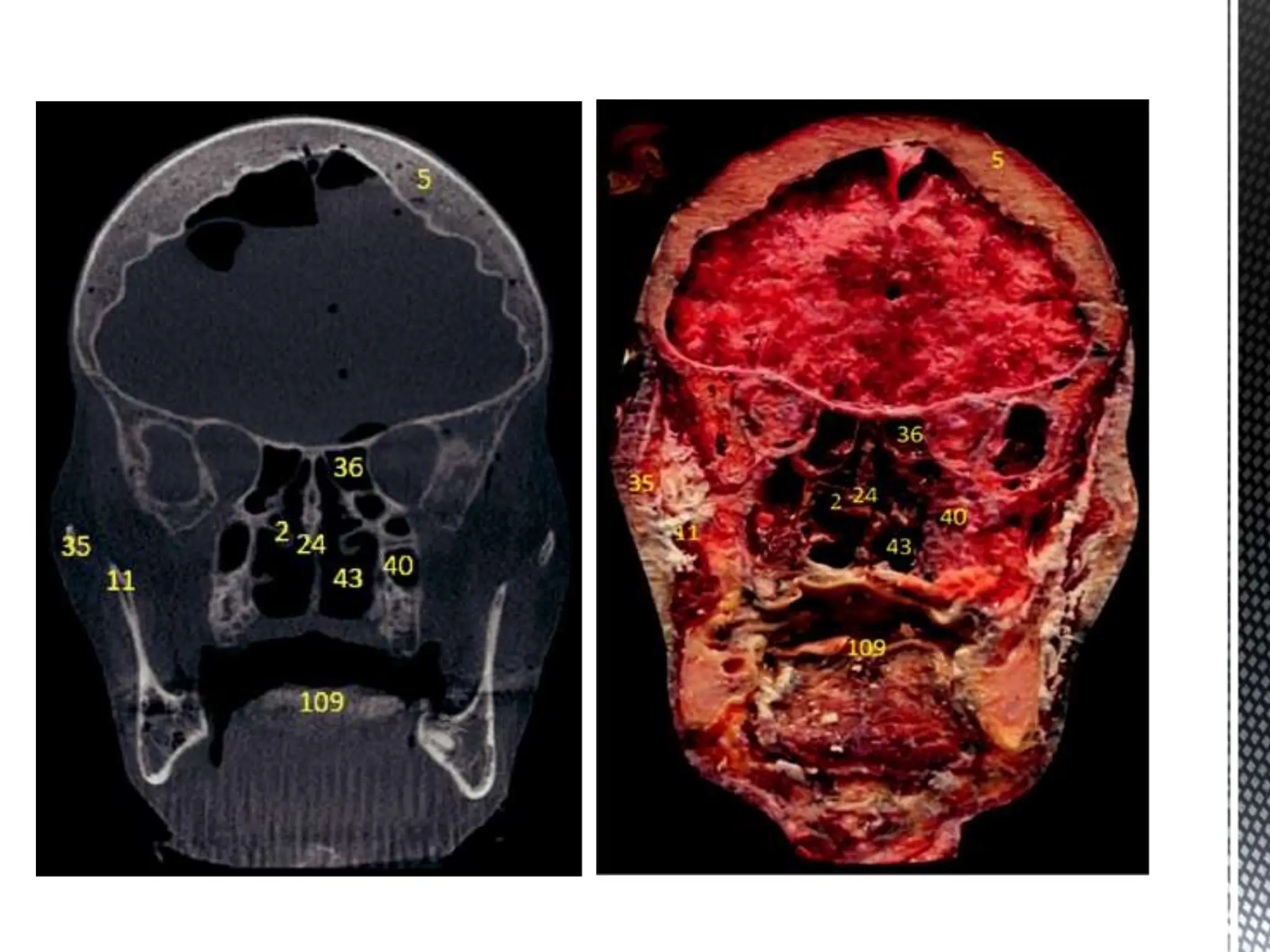 CBCT_INTERPRETATION CBCT APPLICATIONS & READING.pptx