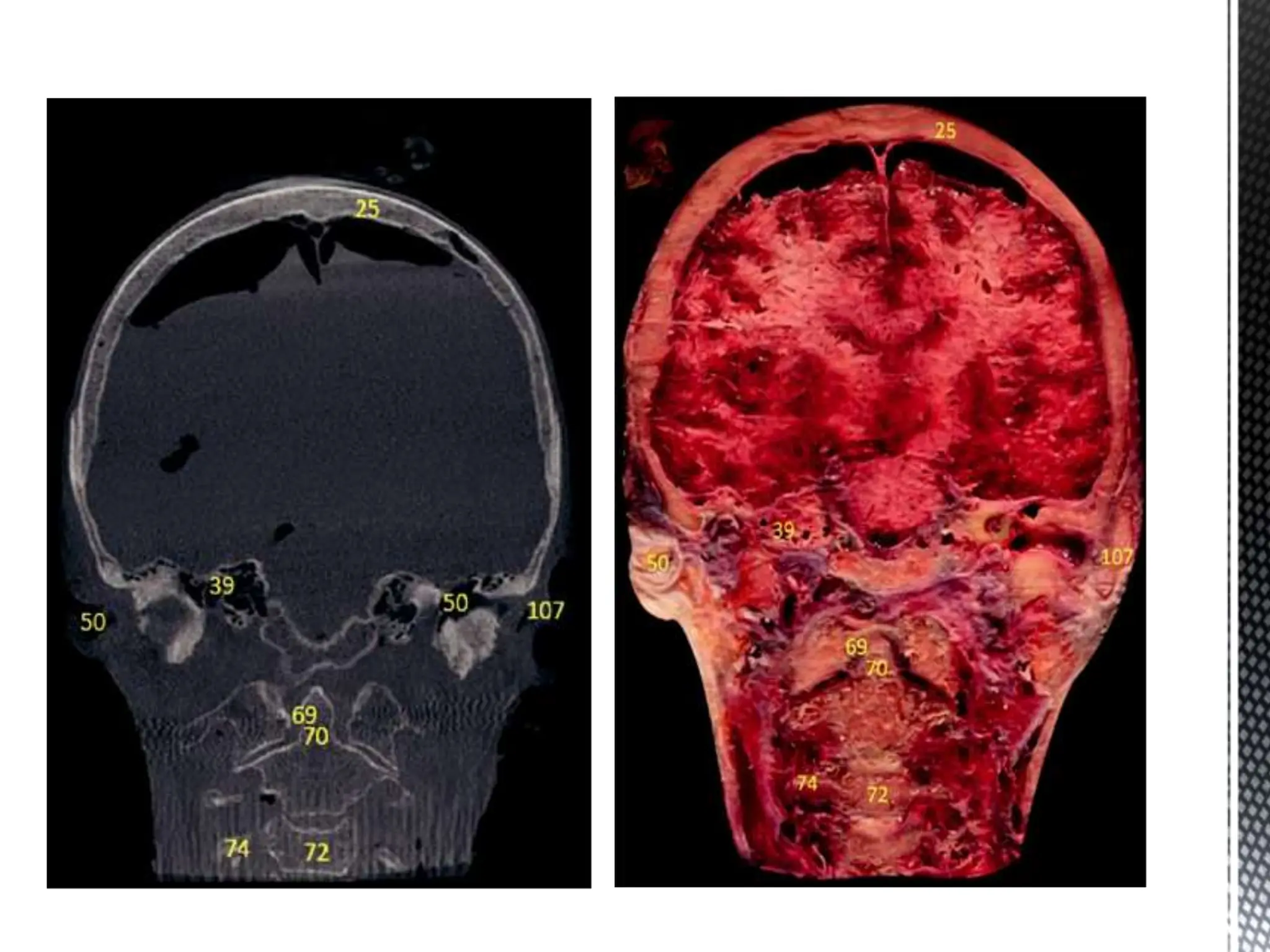 CBCT_INTERPRETATION CBCT APPLICATIONS & READING.pptx