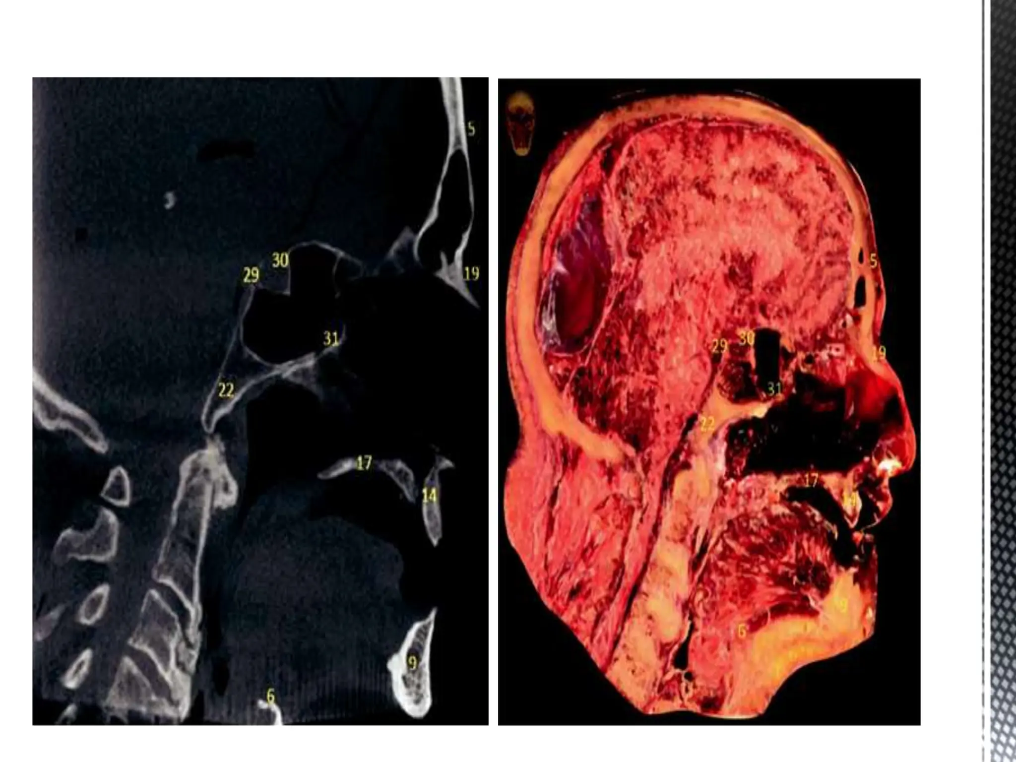 CBCT_INTERPRETATION CBCT APPLICATIONS & READING.pptx