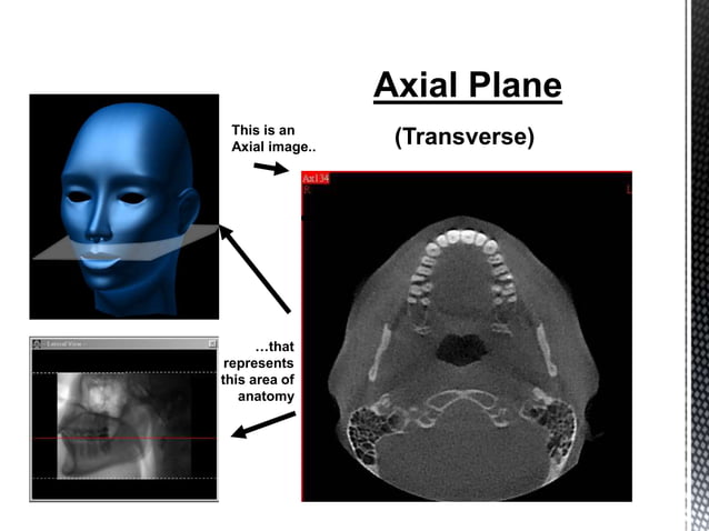 CBCT_INTERPRETATION CBCT APPLICATIONS & READING.pptx