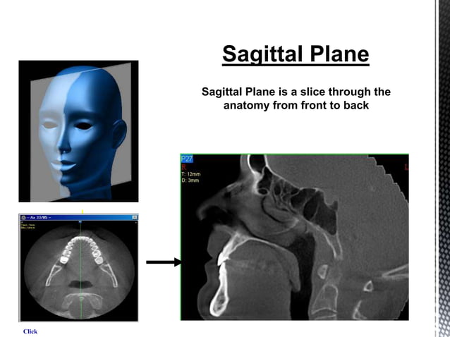 CBCT_INTERPRETATION CBCT APPLICATIONS & READING.pptx