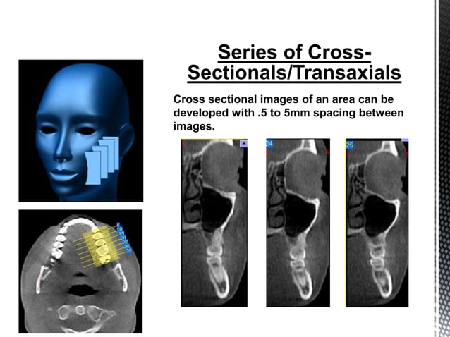 CBCT_INTERPRETATION CBCT APPLICATIONS & READING.pptx