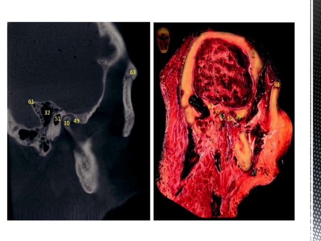 CBCT_INTERPRETATION CBCT APPLICATIONS & READING.pptx