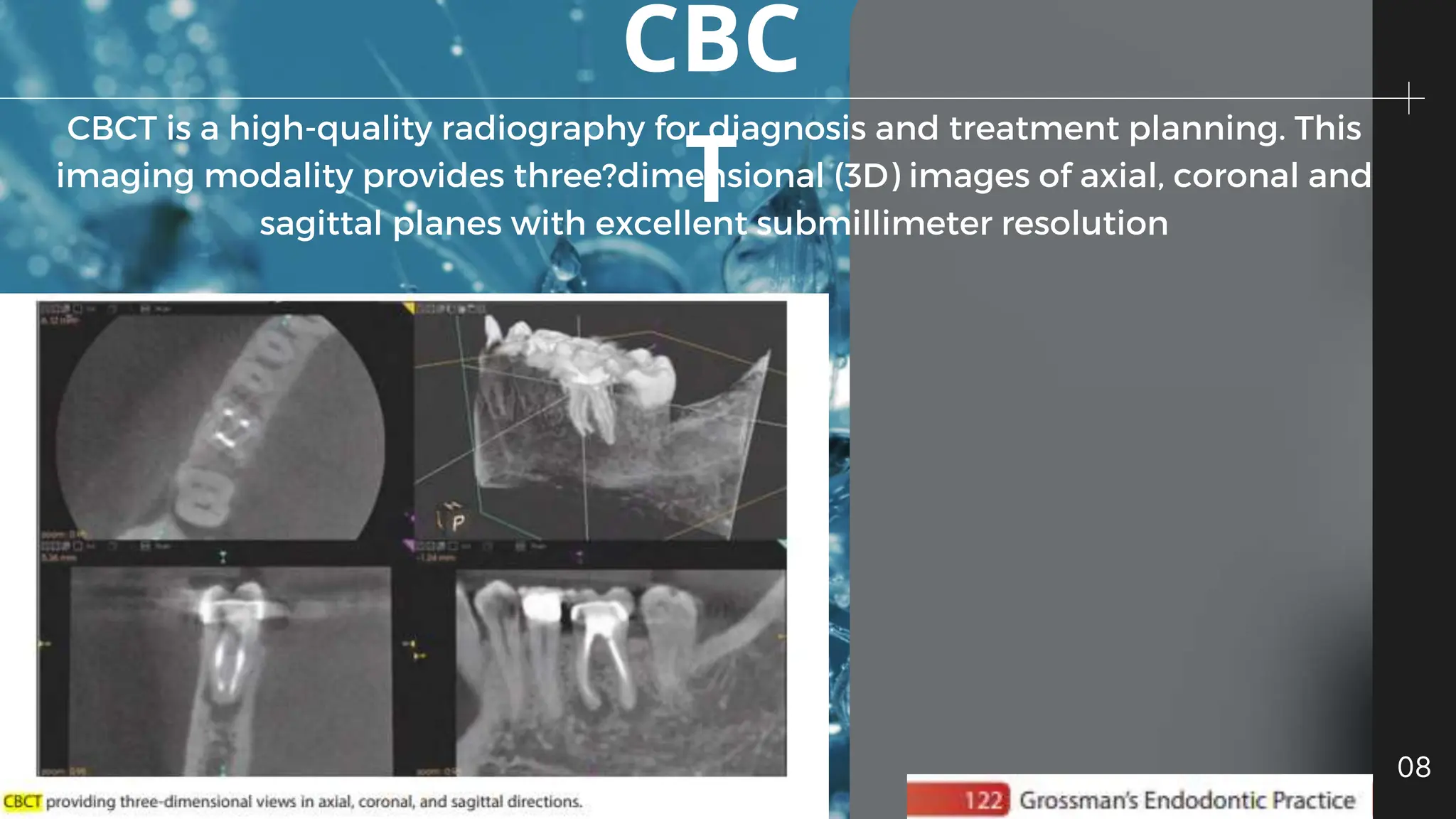Cone beam computed tomography arina PPT.pptx