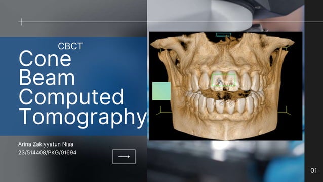 Cone beam computed tomography arina PPT.pptx