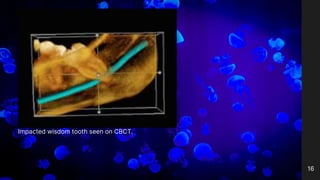 Cone beam computed tomography arina PPT.pptx