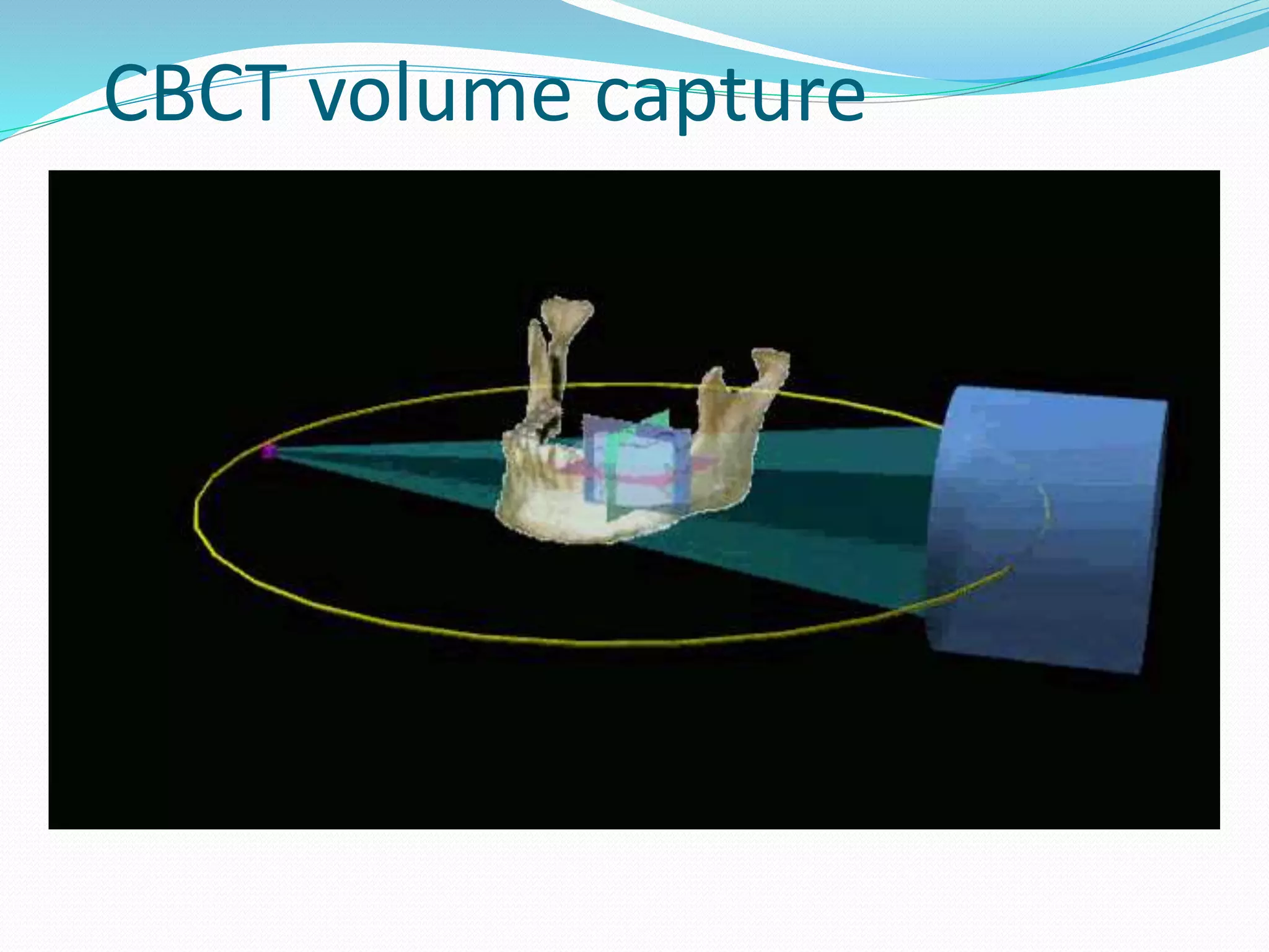 CBCT | PPTX