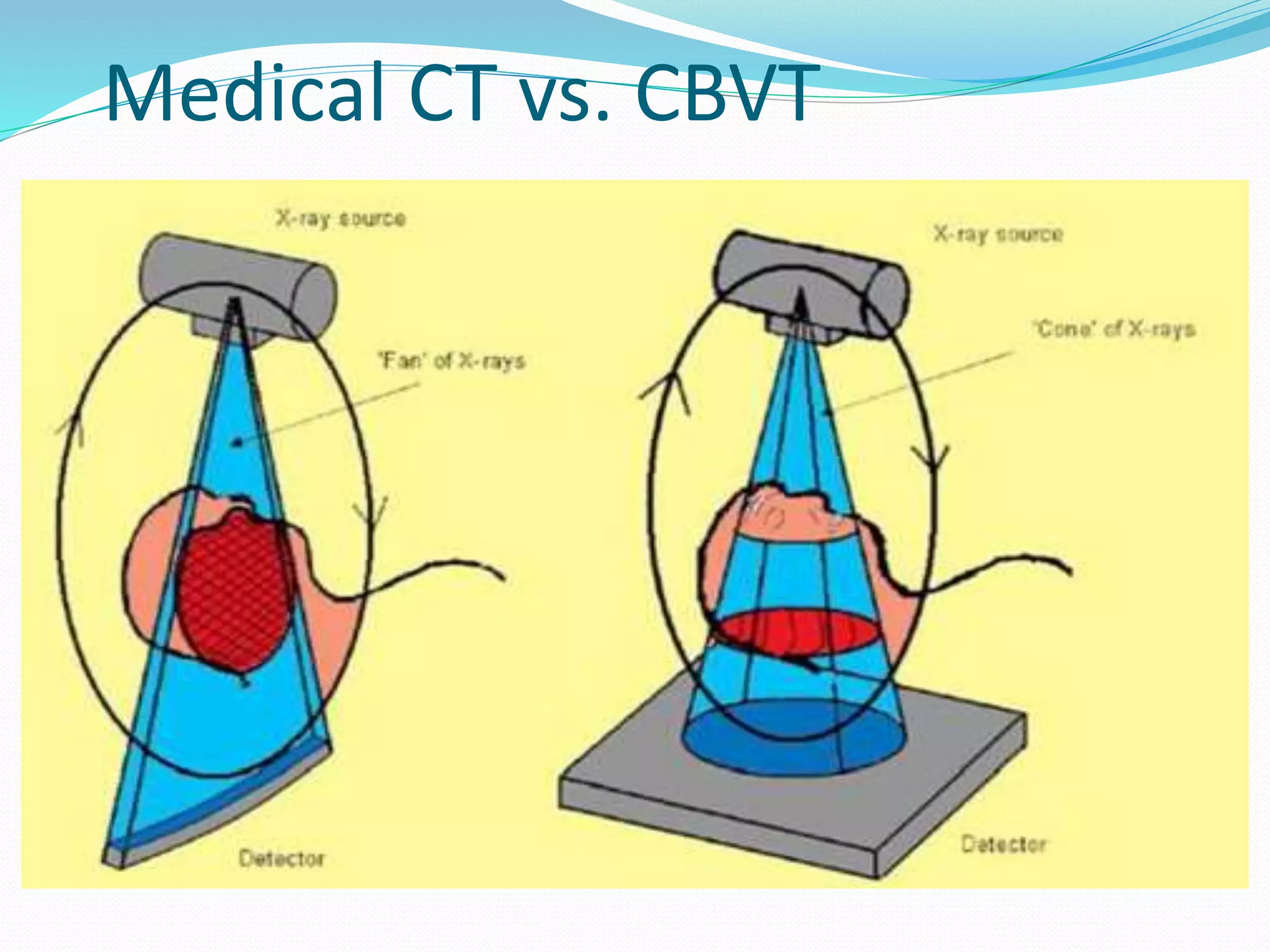 CBCT | PPTX