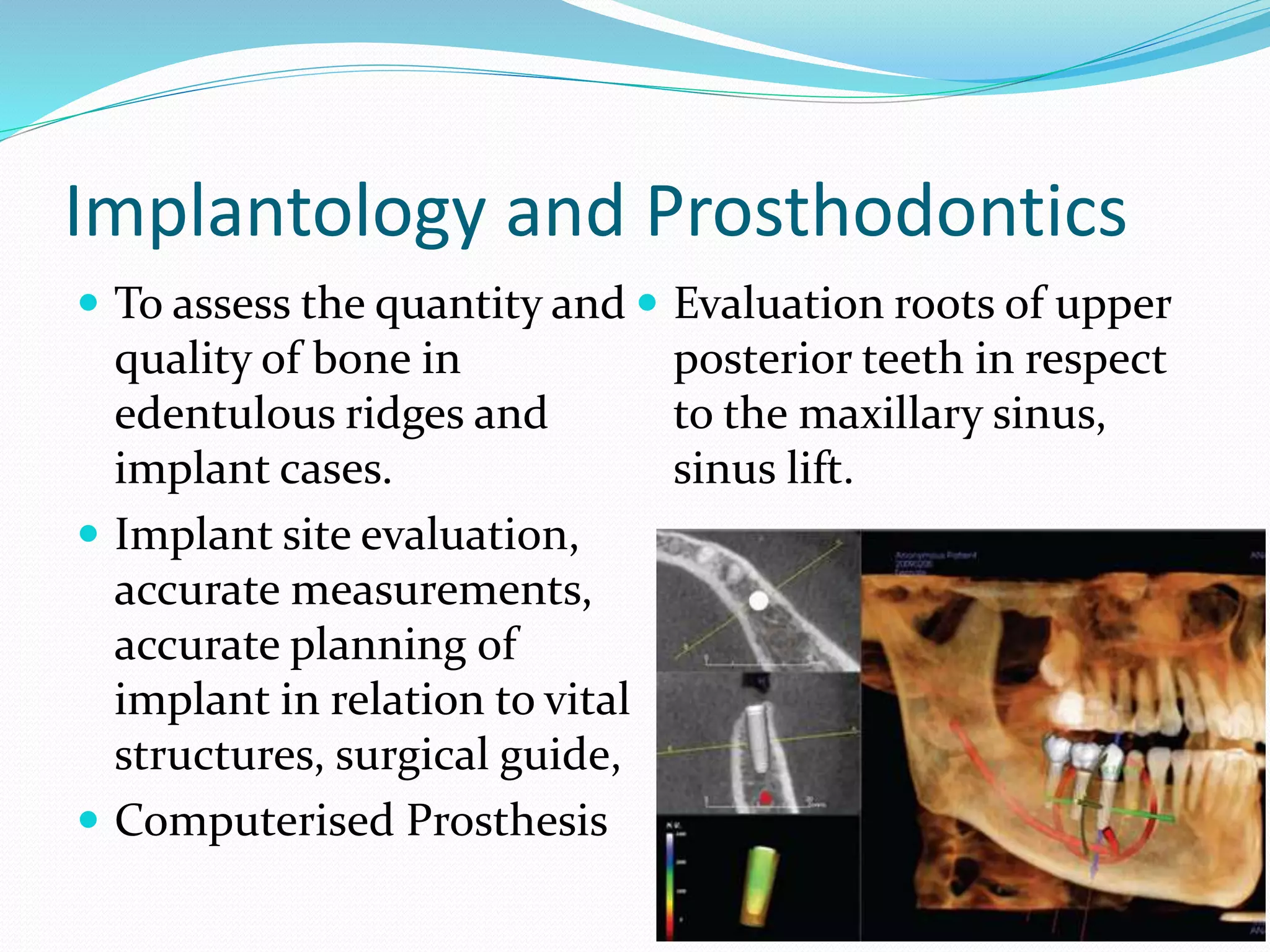 CBCT | PPTX