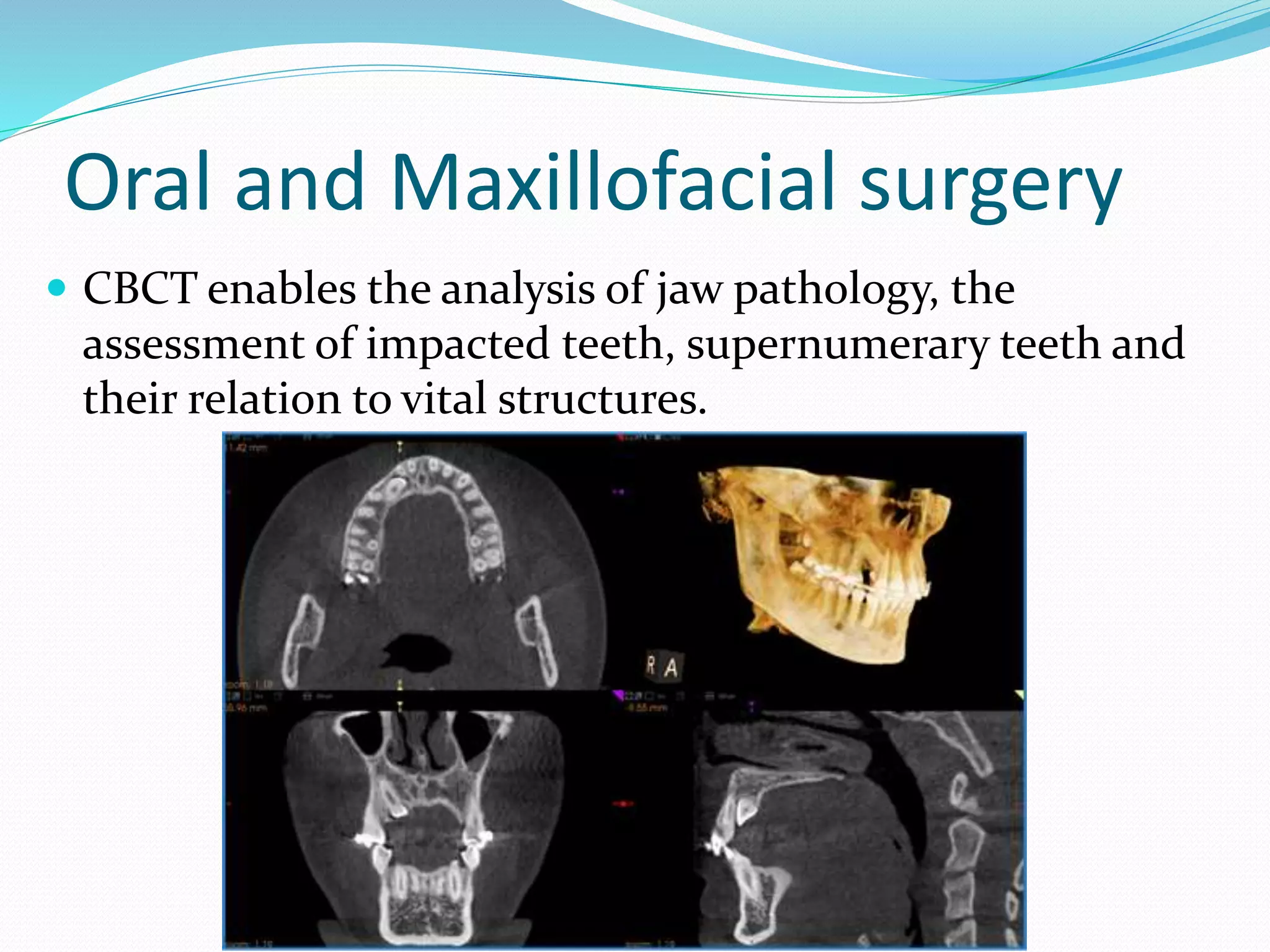 CBCT | PPTX