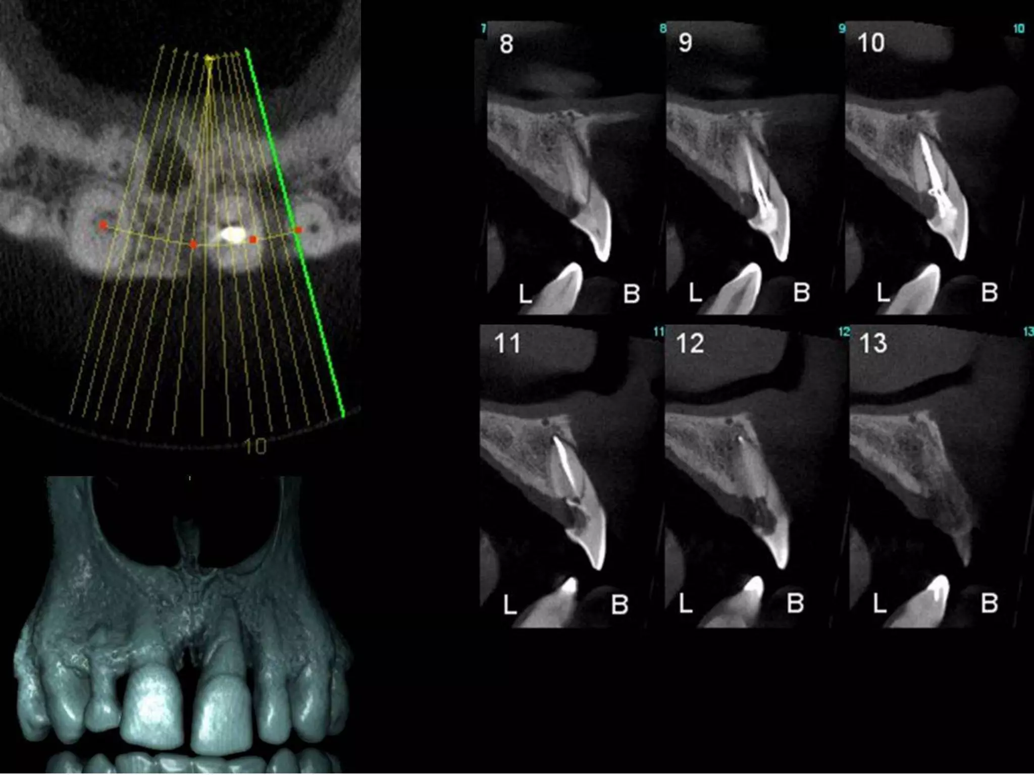 CBCT | PPTX
