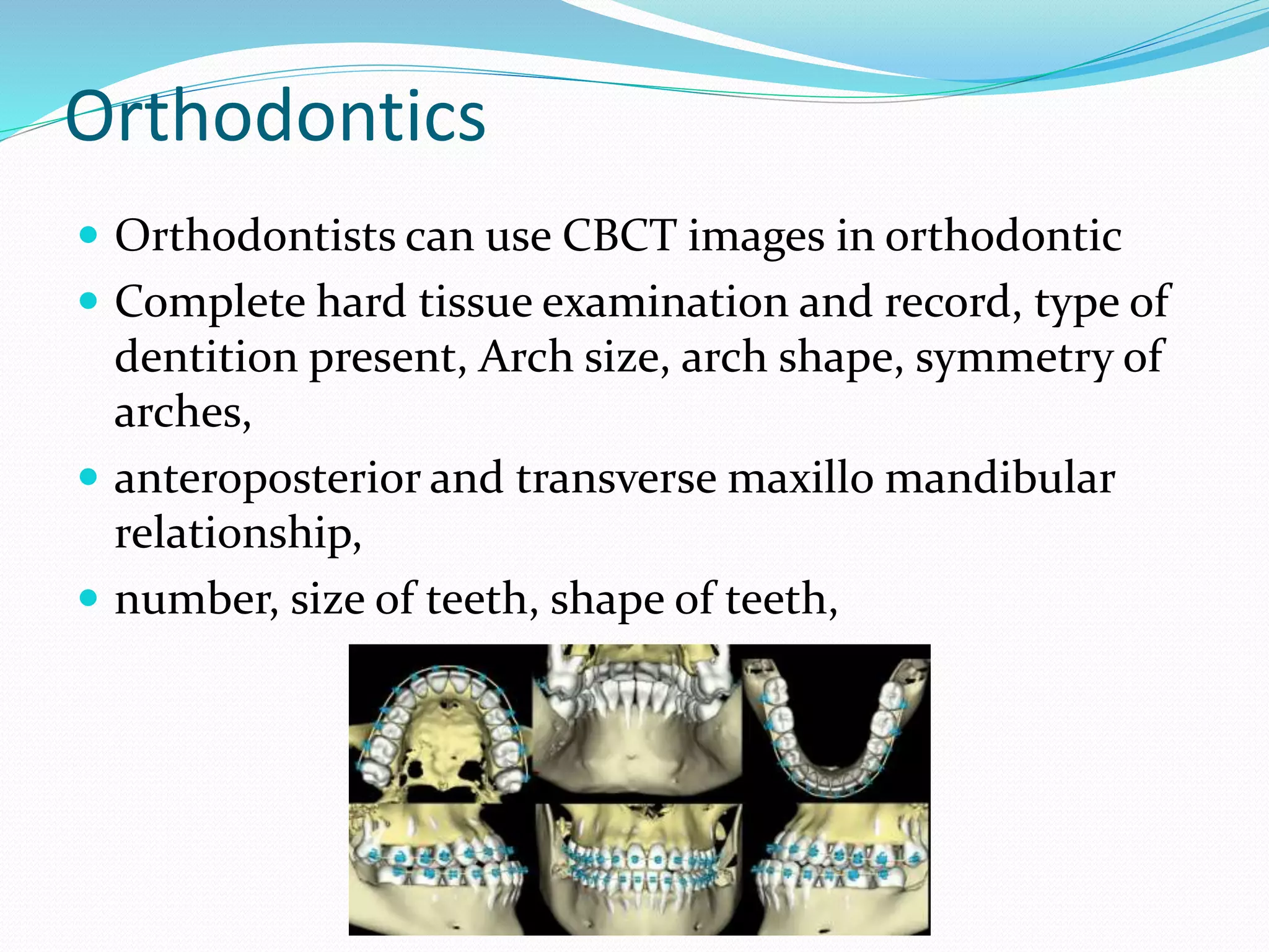 CBCT | PPTX