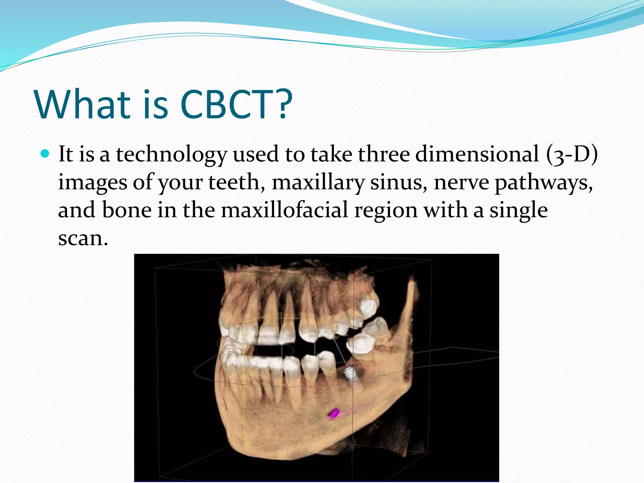 CBCT | PPTX