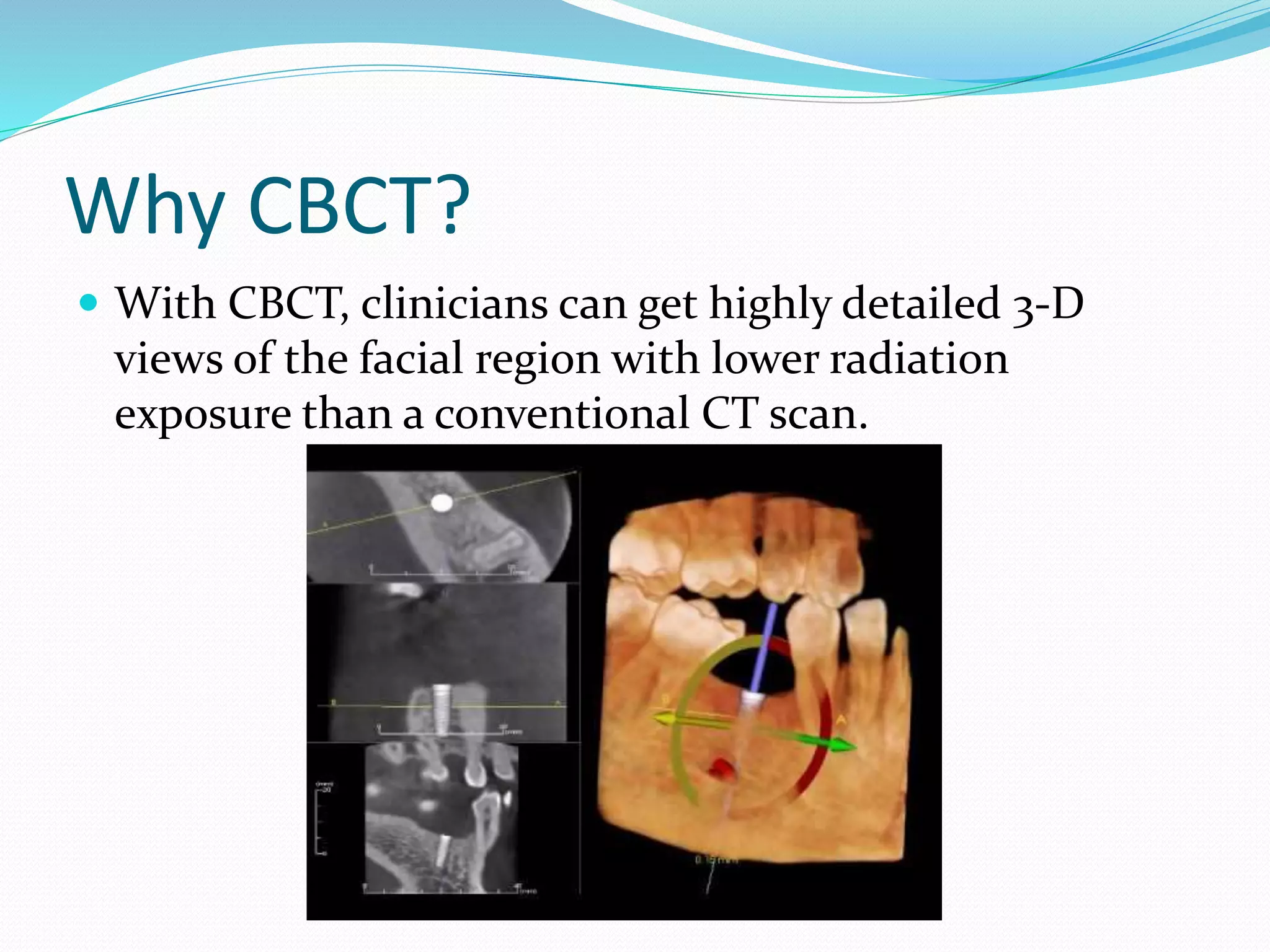 CBCT | PPTX
