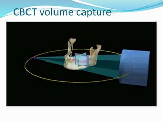 CBCT | PPTX