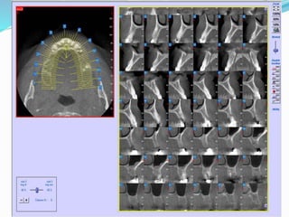 CBCT | PPTX