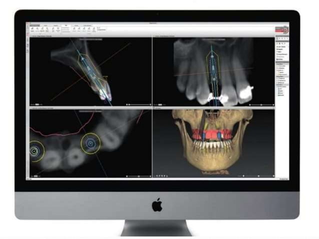 CBCT | PPTX | Dental Health | Diseases and Conditions