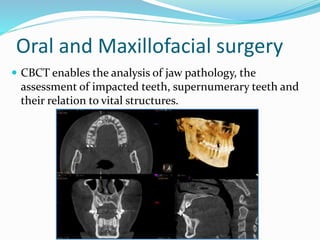 CBCT | PPTX
