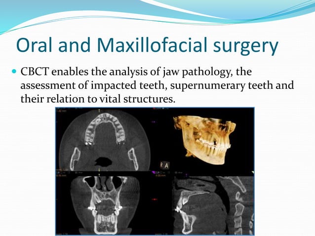 CBCT | PPTX | Dental Health | Diseases and Conditions