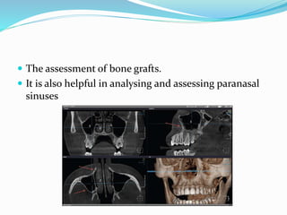 CBCT | PPTX