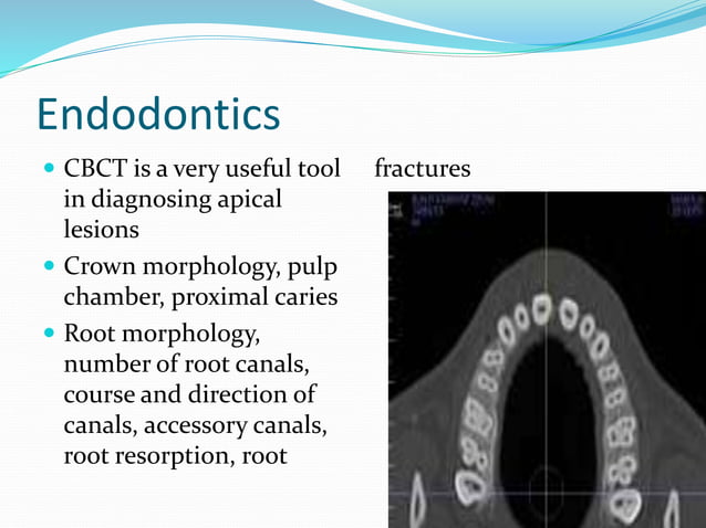 CBCT | PPTX | Dental Health | Diseases and Conditions