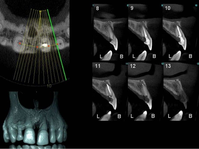 CBCT | PPTX | Dental Health | Diseases and Conditions