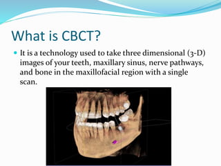 CBCT | PPTX