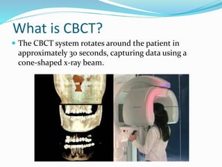 CBCT | PPTX
