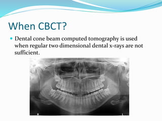 CBCT | PPTX