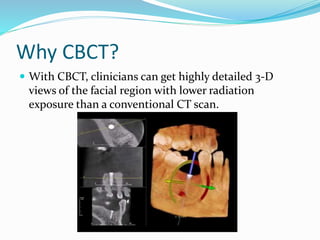 CBCT | PPTX