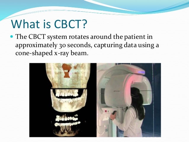 CBCT