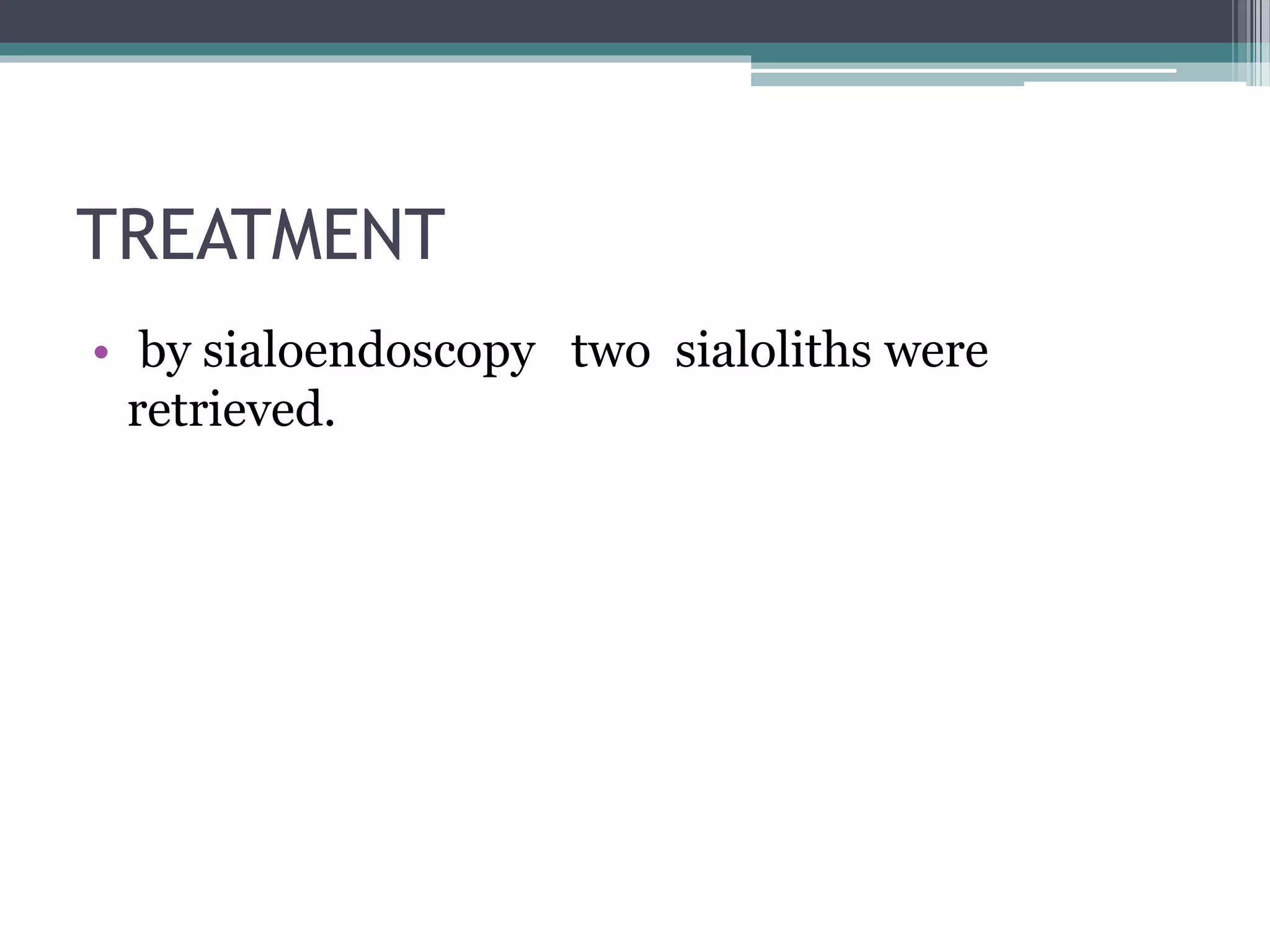 Cbct sialography | PPTX
