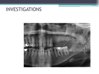 Cbct sialography | PPTX