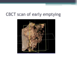 Cbct sialography | PPTX
