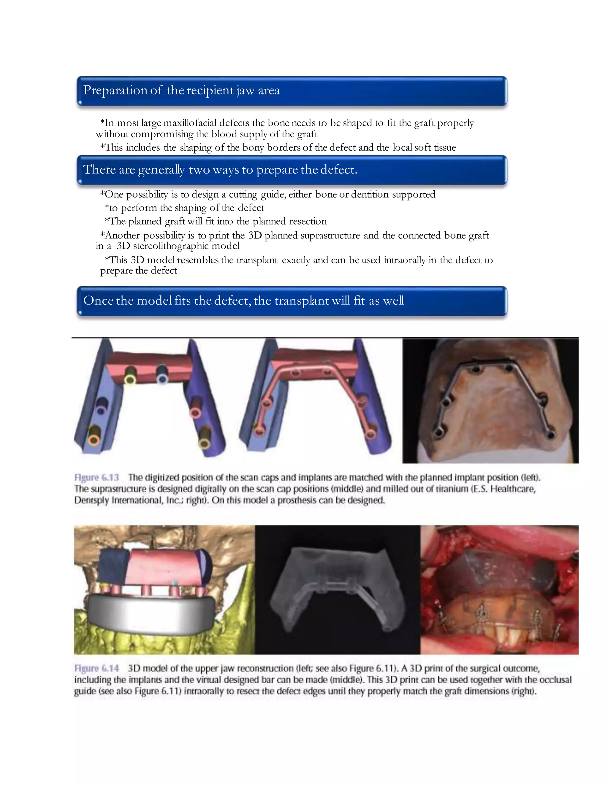 use of Cbct in dental implant | DOCX
