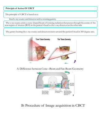 use of Cbct in dental implant | DOCX