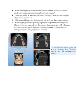 use of Cbct in dental implant | DOCX