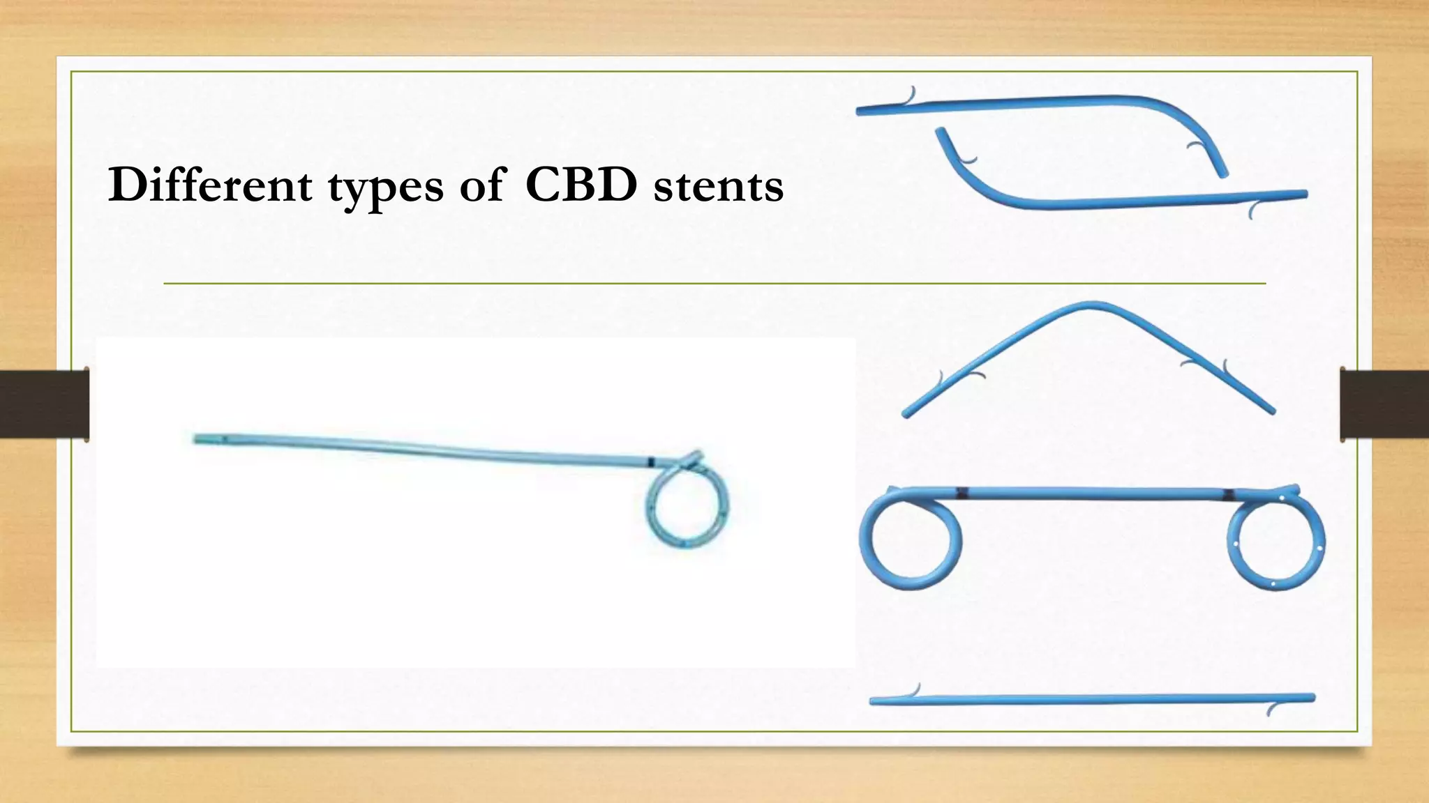 CBD Stent PPT.pptx