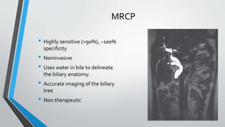 CBD stones/ Choledocholithiais / Biliary stones | PPTX