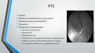 CBD stones/ Choledocholithiais / Biliary stones | PPTX