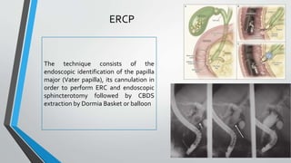 CBD stones/ Choledocholithiais / Biliary stones | PPTX