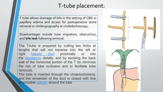 CBD stones/ Choledocholithiais / Biliary stones | PPTX