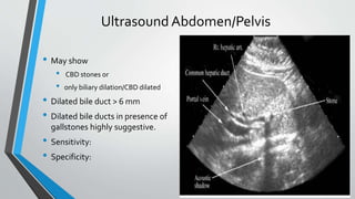 CBD stones/ Choledocholithiais / Biliary stones | PPTX