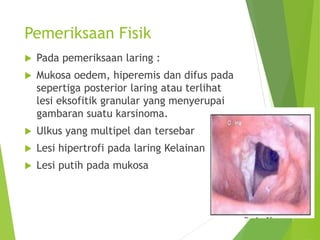 CBD Tuberkulosis Laring | PPTX