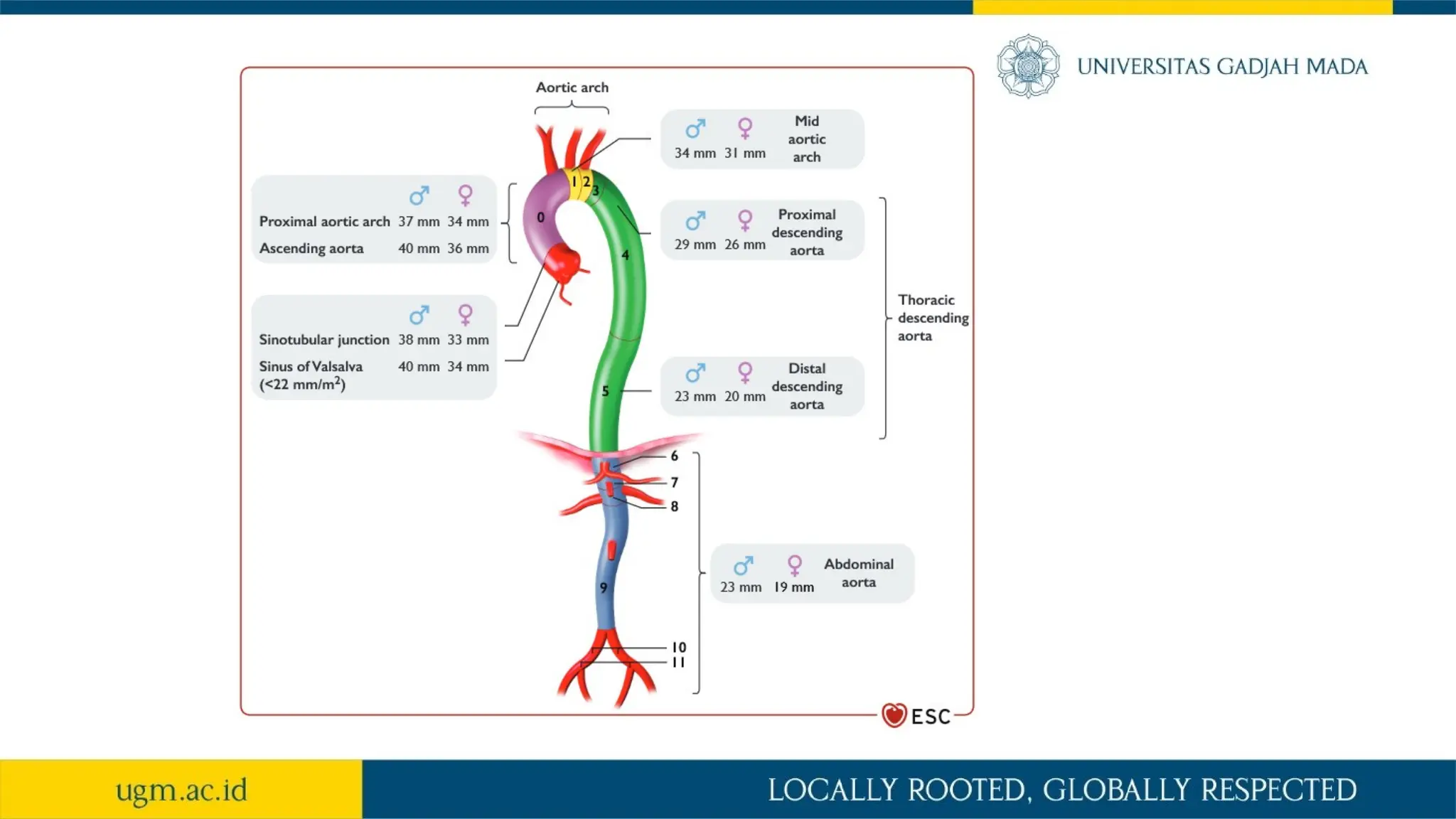 CBD stase vaskular Personaldi- TEVAR.pptx