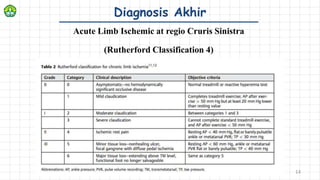 Acute Limb Ischemic : A case report.pptx