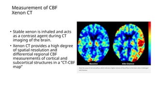 Cerebral blood flow autoregulation and brain energy metabolism | PPTX