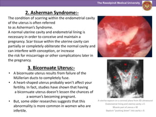 CBL INFERTILITY.pptx